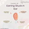 5 Steps to Remove Earrings Stuck in Ears